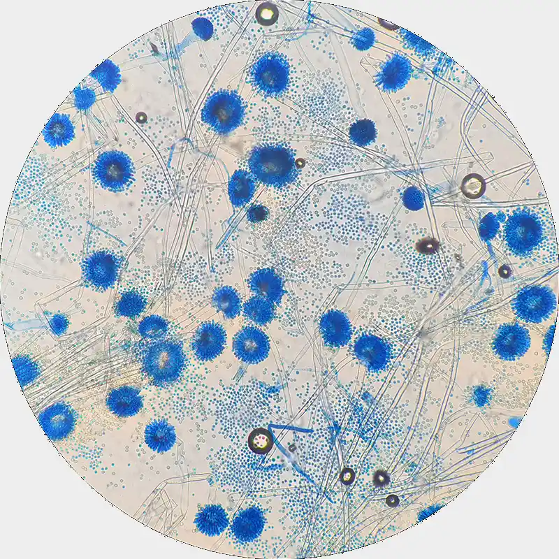 Mycotoxin Mould Panel - The Forbes Clinic of Integrative Medicine